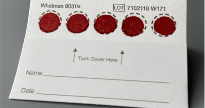 Dried Blood Spot Method - National Viral Hepatitis Roundtable